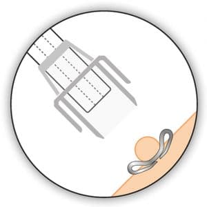 OTSC® System Set - Ovesco Endoscopy AG