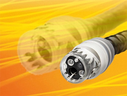 Home - Ovesco Endoscopy AG