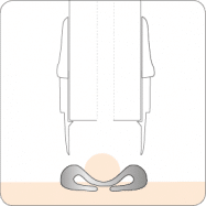 OTSC® System Set - Ovesco Endoscopy AG
